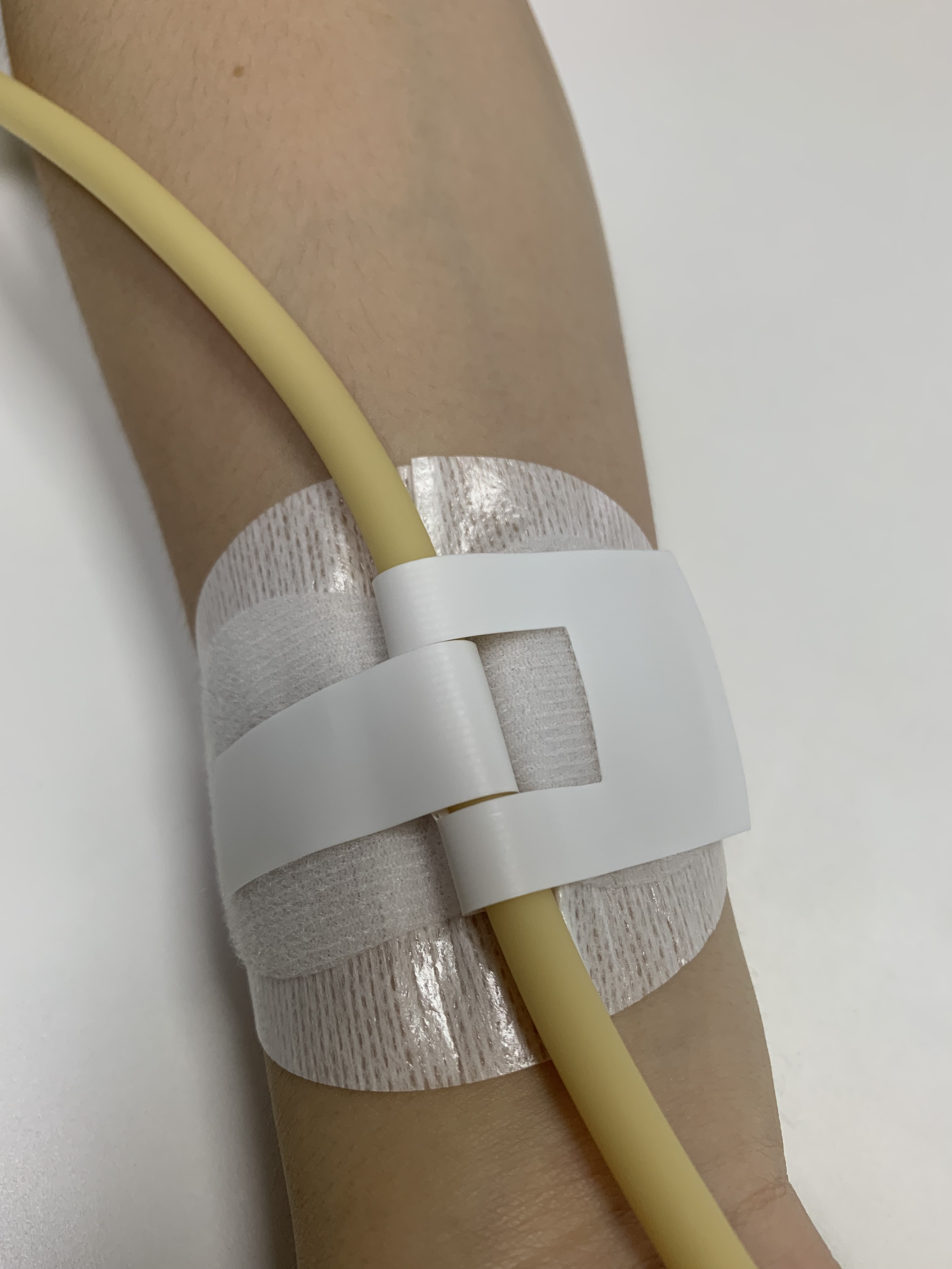 OEM Catheter stabilization Device Catheter Legband Fixation Stickers ...